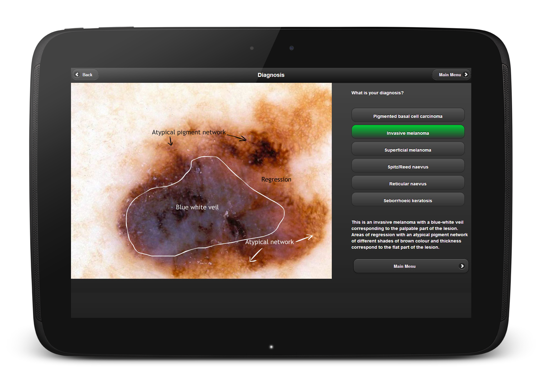 Dermoscopy @ Cardiff