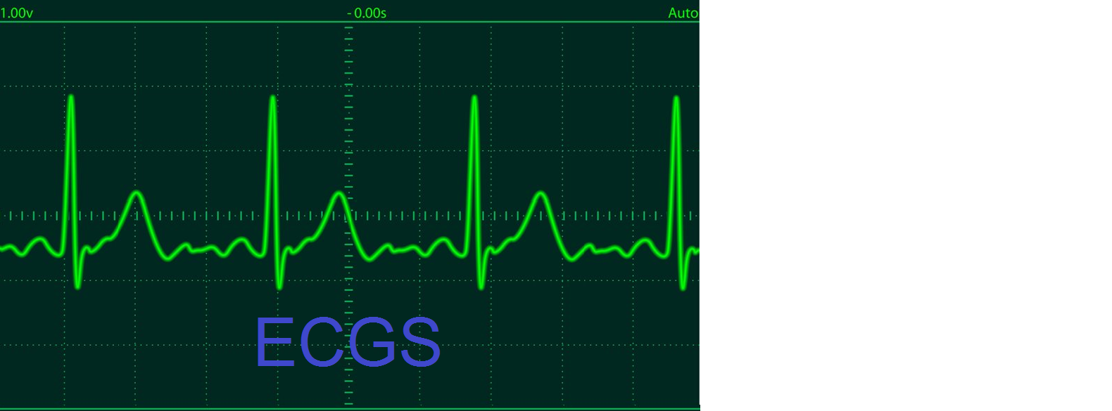 Interactive Learning Object